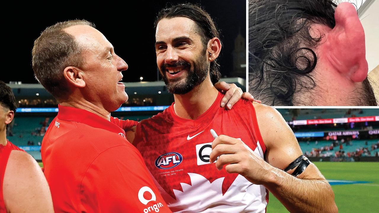 Afl News 2024 Brodie Grundy On Bluebottle Sting Max Gawn Duel In