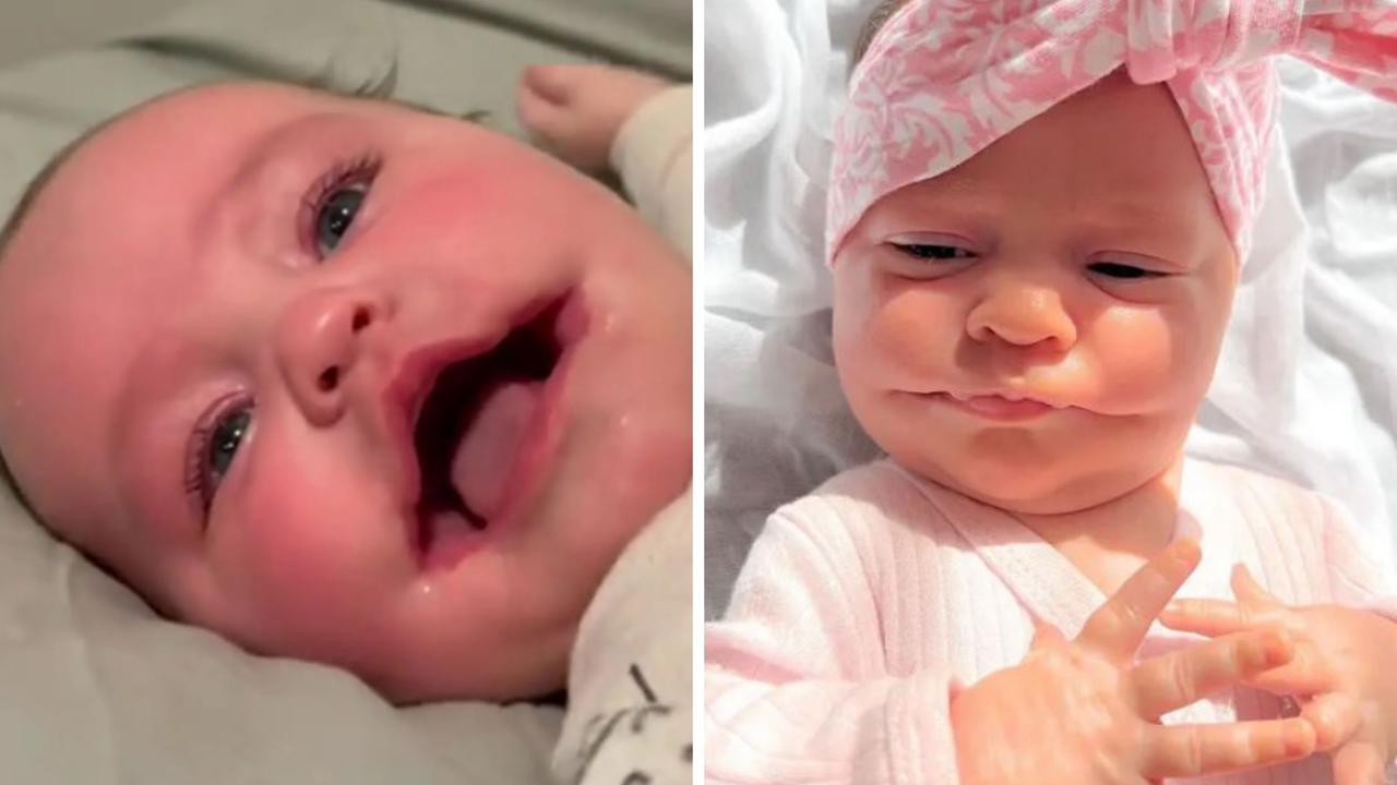 Adelaide parents discover baby has bilateral macrostomia, a ‘permanent ... Adelaide parents discover baby has bilateral macrostomia, a ‘permanent ...