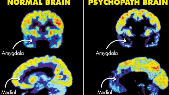 How to tell if your child is a future psychopath | news.com.au ... How to tell if your child is a future psychopath | news.com.au ...
